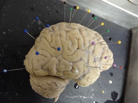 Neuro Lab 1 Diagram Quizlet