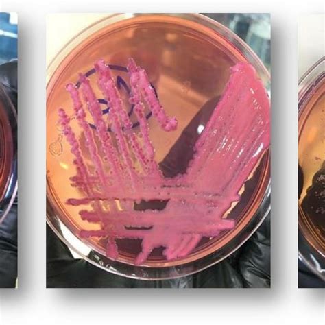 Colonies Of Gram Negative Bacterial Isolate On Macconkey Agar Download Scientific Diagram