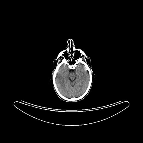 Image Recognition V2 Object Detection Dataset By New Workspace Lyioh