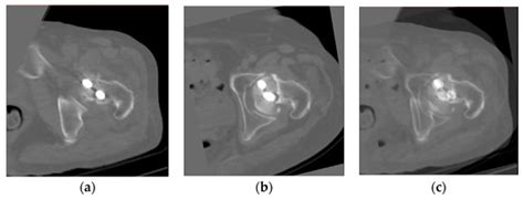 Symmetry Special Issue Multidimensional Signal Processing And Its Applications