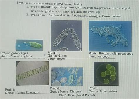 Solved From The Microscope Images 400X Below Identify 1 Chegg Com