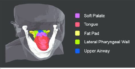 Upper Airway Soft Tissue Volumetric Measurements On Magnetic Resonance Download Scientific