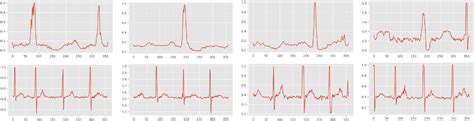 Figure 11 From Generalized Generative Deep Learning Models For Biosignal Synthesis And Modality