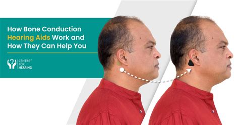 Youll Never Believe How Bone Conduction Hearing Aids Work And How They Can Help You Centre