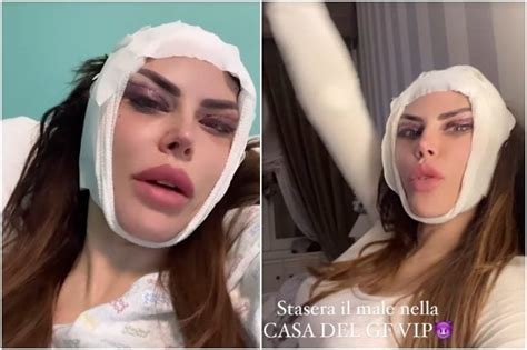 Guendalina Tavassi Dopo La Blefaroplastica Fermarmi Con La Chirurgia