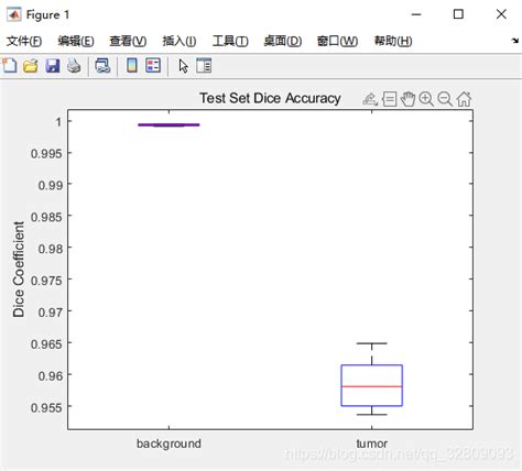 基于matlab深度学习（deep Learning）的3 D U Net 神经网络进行3 D脑部肿瘤mri的分割及三维重建matlab