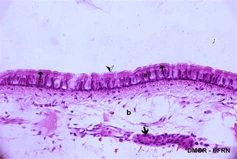 Odontologia Lâminas Tecido Epitelial