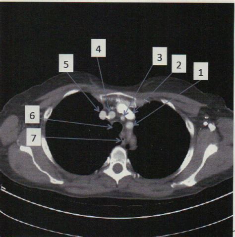 Ct Scan 1 Diagram Quizlet