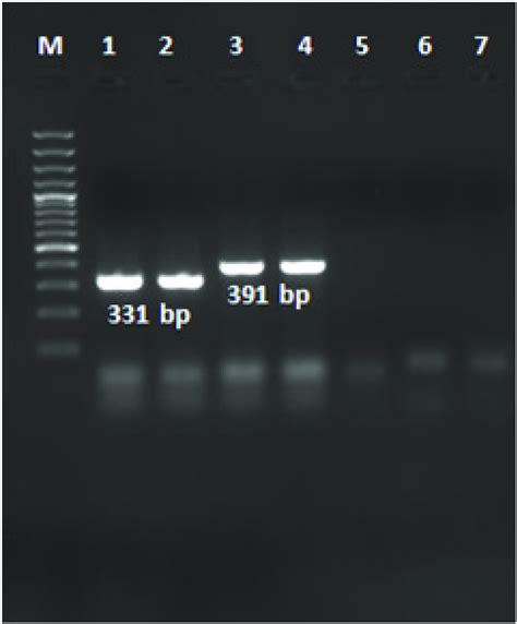 Specificity Of Pcr Assay For The Detection Of Campylobacter Jejuni And Download Scientific