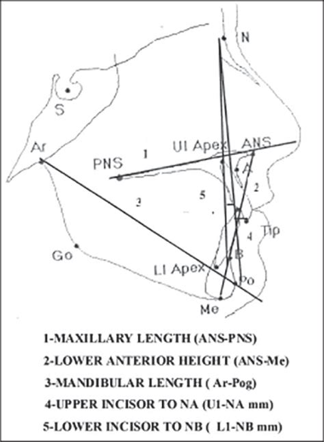 An Evaluation Of The Reproducibility Of Landmark Identification In Traditional Versus Computer