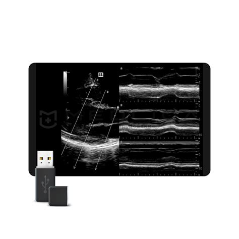 Free Xros M™ купить в Москве по выгодной цене на Medliga