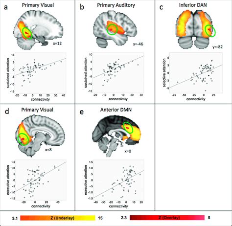Associations With Sustained Selective And Executive Attention In Download Scientific Diagram