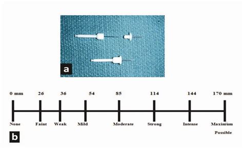 Anesthetic Efficacy Of X Tip Intraosseous Injection Using 2 Journal Of Conservative