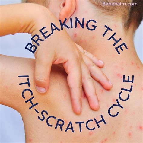 Breaking The Itch Scratch Cycle