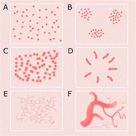 Pdf Dermatoscopy Of Unpigmented Lesions Of The Skin A New