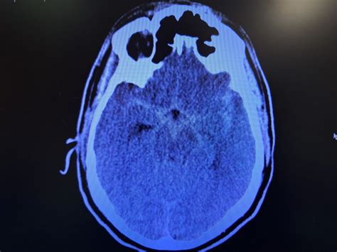 Mohammad Kazem Sarpoolaki On Linkedin Middle Aged Male Presented With