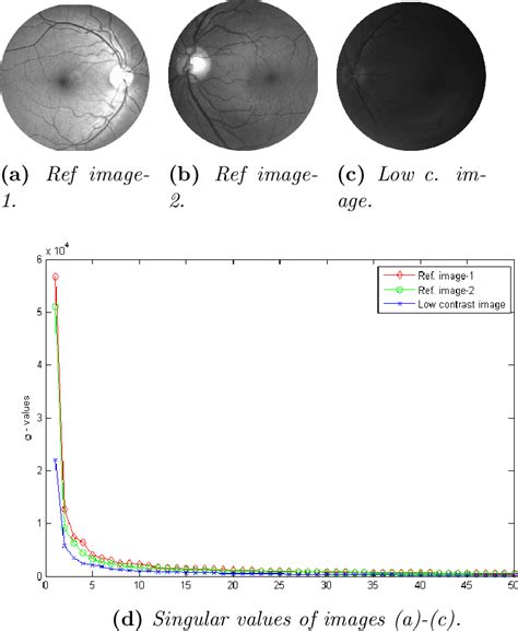 Figure 2 From Automated Detection Of Microaneurysms Using Scale Adapted