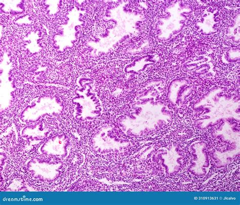 Endometrium Secretory Phase Royalty Free Stock Image 310913626