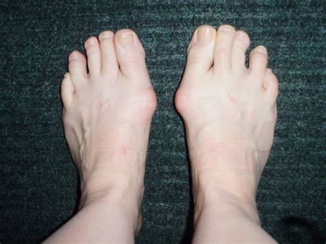 Sisters Feet Images