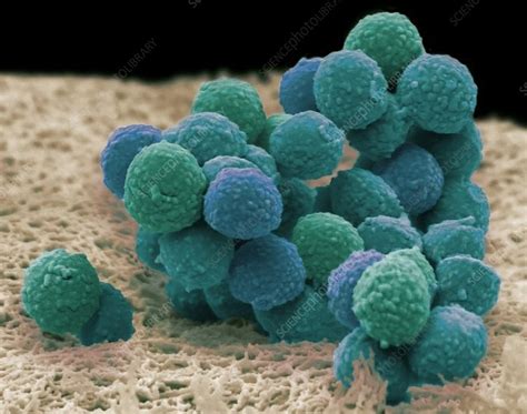 Infezione Da Stafilococco Sulla Pelle Stafilococco Streptococco Pelle