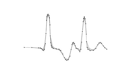 overfitting vs underfitting in machine learning algorithms artificial intelligence