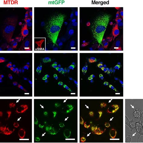 Intercellular Transfer Of Mitochondria Related Vesicles Derived From