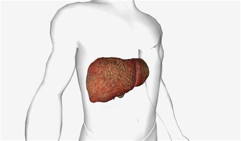 Premium Photo Primary Biliary Cholangitis PBC Is An Autoimmune Disease Of Th