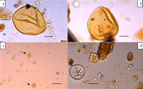 Corn Microremains From Zape Samples A Maize Pollen From Zape 66 Download Scientific Diagram