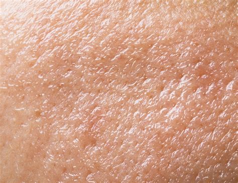 Bumpy Texture On Face