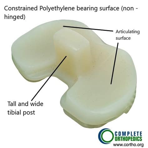 What Is A Polyethylene Insert At Albert Hoopes Blog