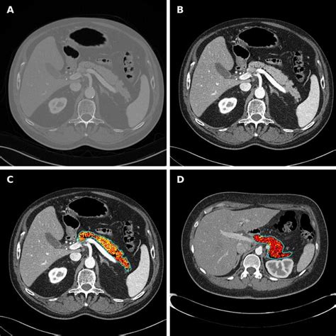Image Processinga B An Example Of An Axial Image Slice Before And Download Scientific Diagram