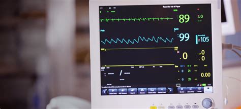 Elevating Cardiac Care Iots Role In Remote Ecg Monitoring Freeeway