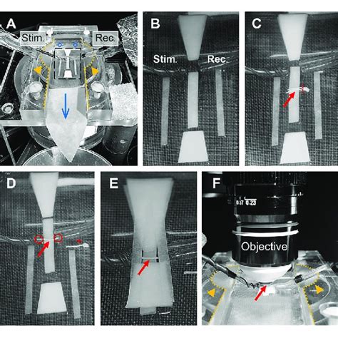 Intravitreal Aav Injection Procedure A Depiction Of The Mouse Eye Download Scientific
