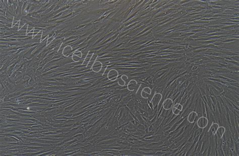 人原代瘢痕疙瘩成纤维细胞 原代细胞 Str细胞 细胞培养基 镜像绮点生物