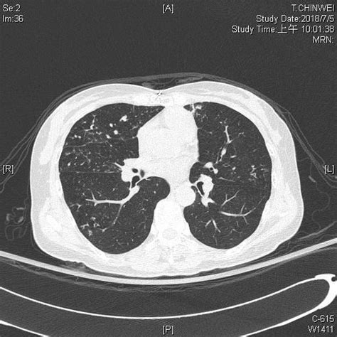 Bc Datasets Object Detection Dataset By Cgmh