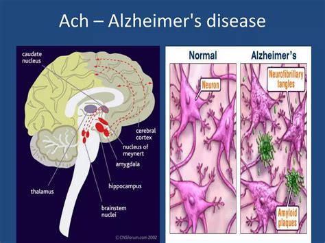 Neurotransmitters Pptx Endocrine And Metabolic Diseases Diseases