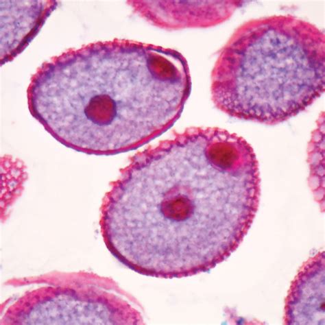 Lily Anther Mature Pollen Grains C S 12 µm Microscope Slide Carolina Biological Supply