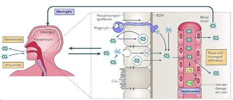 Schematic Presentation Of Transmission And Pathogenesis Of Meningococci