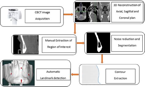 Overview Of The Proposed Methodology For Landmark Detection Download Scientific Diagram