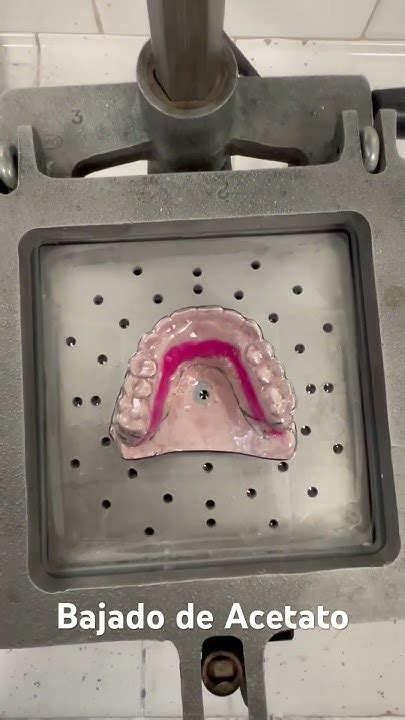 10 Guarda Oclusal Bajado De Acetato Youtube