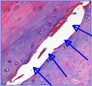 The Plantar Fascia Enthesis