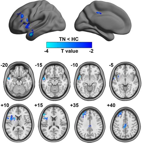 Brain Behavior Relationships The Rsfc Strength Of The Pcc To The Mpfc