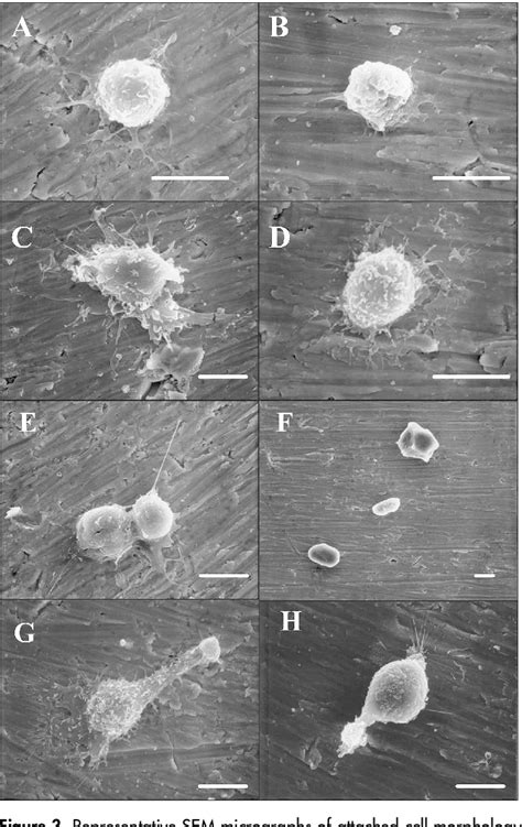 Figure 1 From Osteoblast Precursor Cell Attachment On Heat Treated Calcium Phosphate Coatings