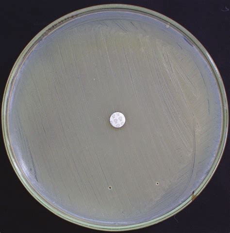 Detection Of Methicillin Resistance In Staphylococcus Aureus By Polymerase Chain Reaction And