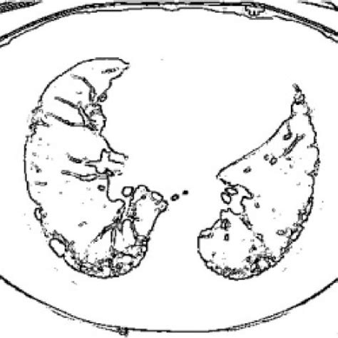 Ct Image After Applying Histogram Equalizer Download Scientific Diagram