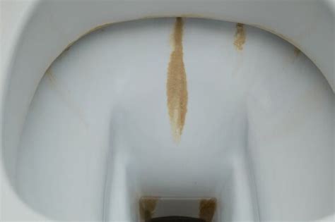 Chemical Free 95p Method Breaks Down Limescale In Toilet Bowls