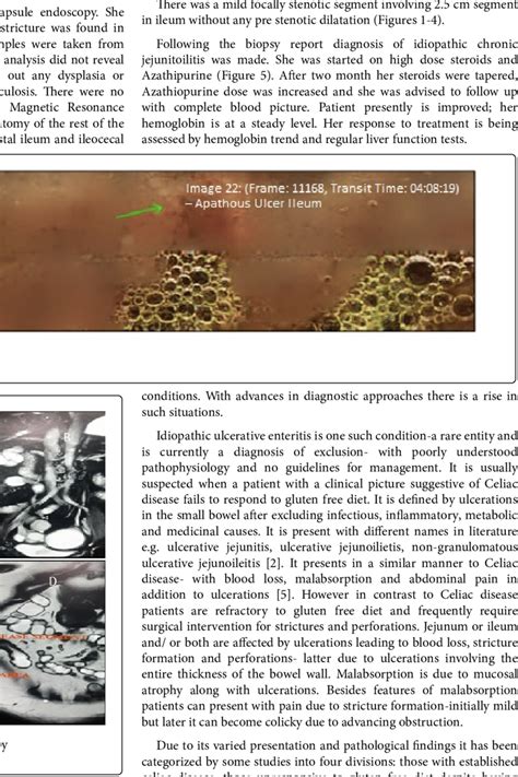 Apathous Ulcer Ileum Frame 11168 Download Scientific Diagram