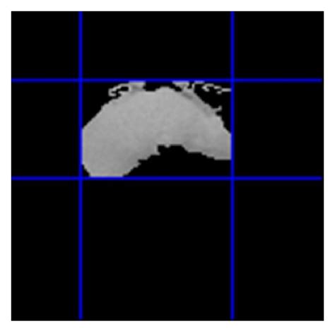 Comparisons Of Liver Segmentation Based On Growcut And Kigc Download Scientific Diagram