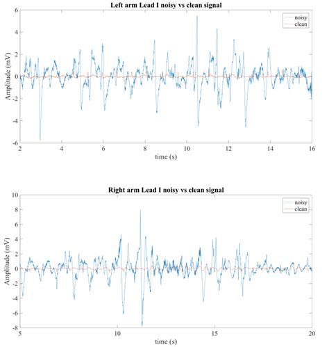 Github Treastorgavinbiosignalsecgsignalprocessing