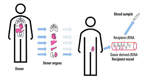 Life Cycle Of Donor Derived CfDNA From Peripheral Blood CfDNA Download Scientific Diagram